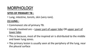 RESPIRATORY SYSTEM Tuberculosis pathology.pptx