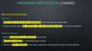 RESPIRATORY TRACT PATHOLOGY | PPTX