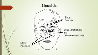 Respiratory tract infection | PPTX
