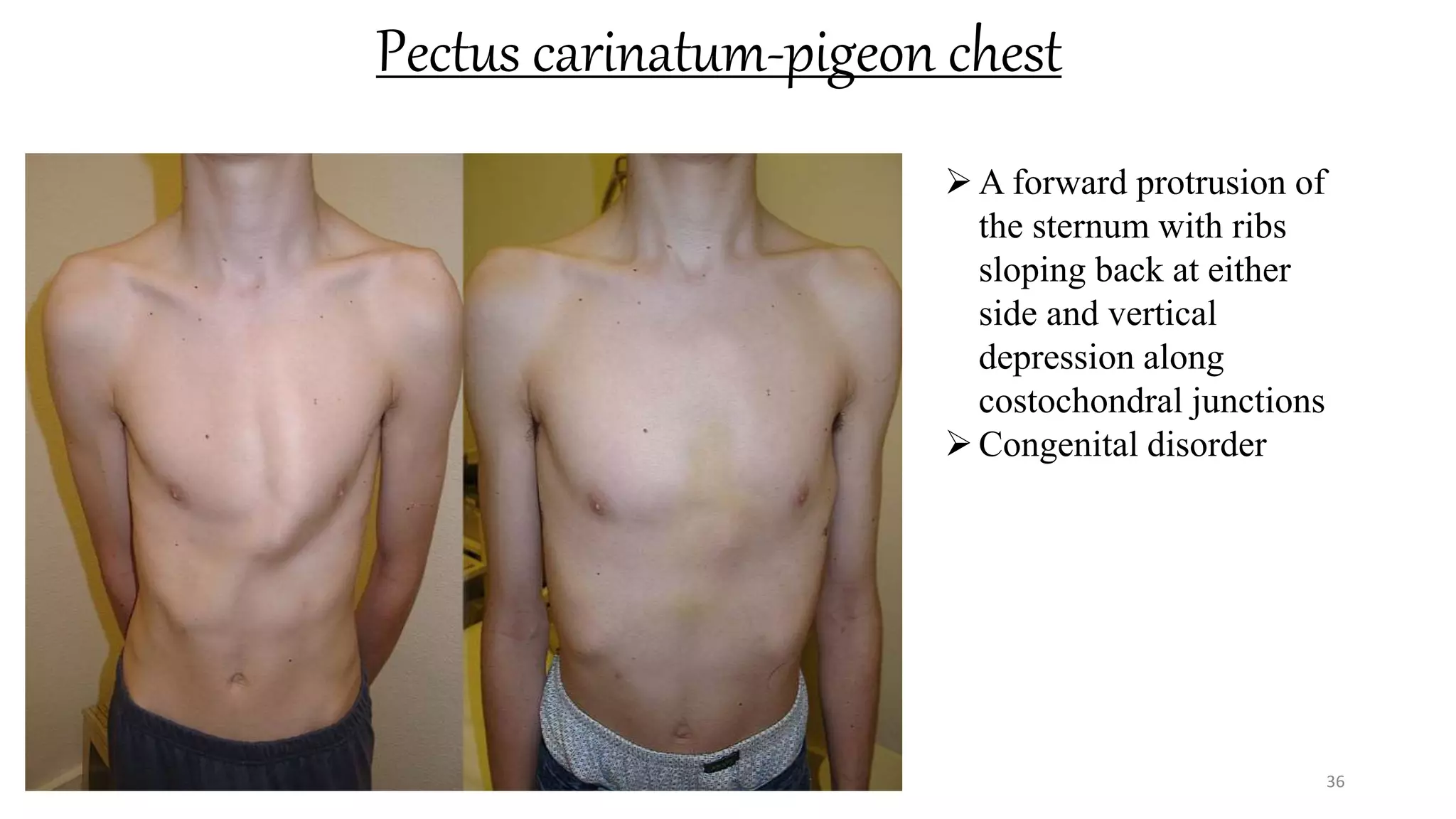 Respiratory assessment | PPTX