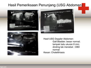 Responsi Kolelitiasis | PPT