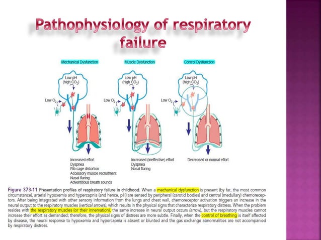 Resp physiology & respiratory failure in children | PPTX | Lung and ...