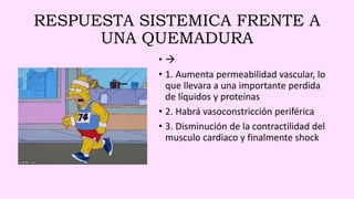Respuesta fisiologica a la lesion por quemadura | PPT