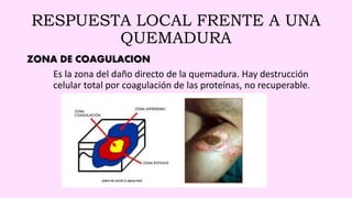 Respuesta fisiologica a la lesion por quemadura | PPT