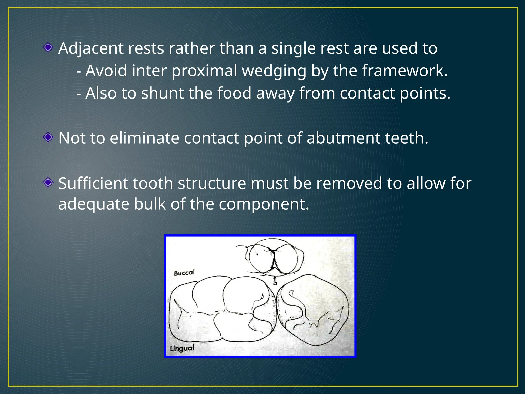 Rest and Rest Seat in Removable partial denture | PPTX
