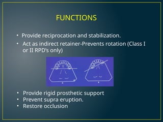 Rest and Rest Seat in Removable partial denture | PPTX