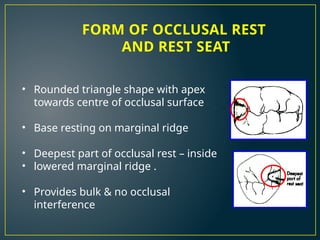 Rest and Rest Seat in Removable partial denture | PPTX