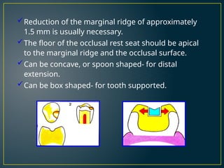 Rest and Rest Seat in Removable partial denture | PPTX