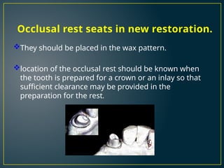Rest and Rest Seat in Removable partial denture | PPTX