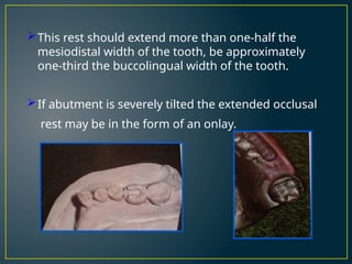 Rest and Rest Seat in Removable partial denture | PPTX