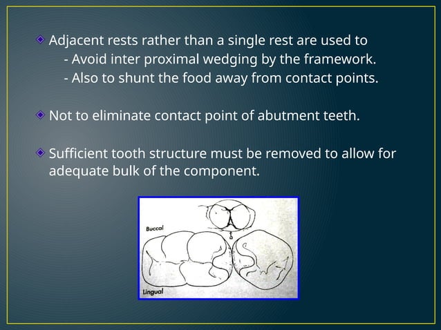 Rest and Rest Seat in Removable partial denture | PPTX