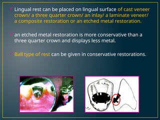 Rest and Rest Seat in Removable partial denture | PPTX