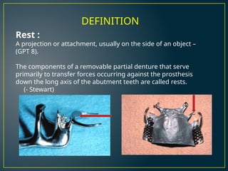 Rest and Rest Seat in Removable partial denture | PPTX