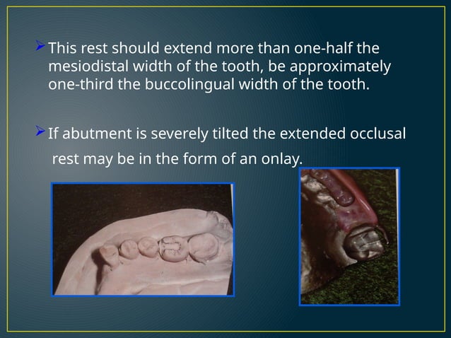 Rest and Rest Seat in Removable partial denture | PPTX