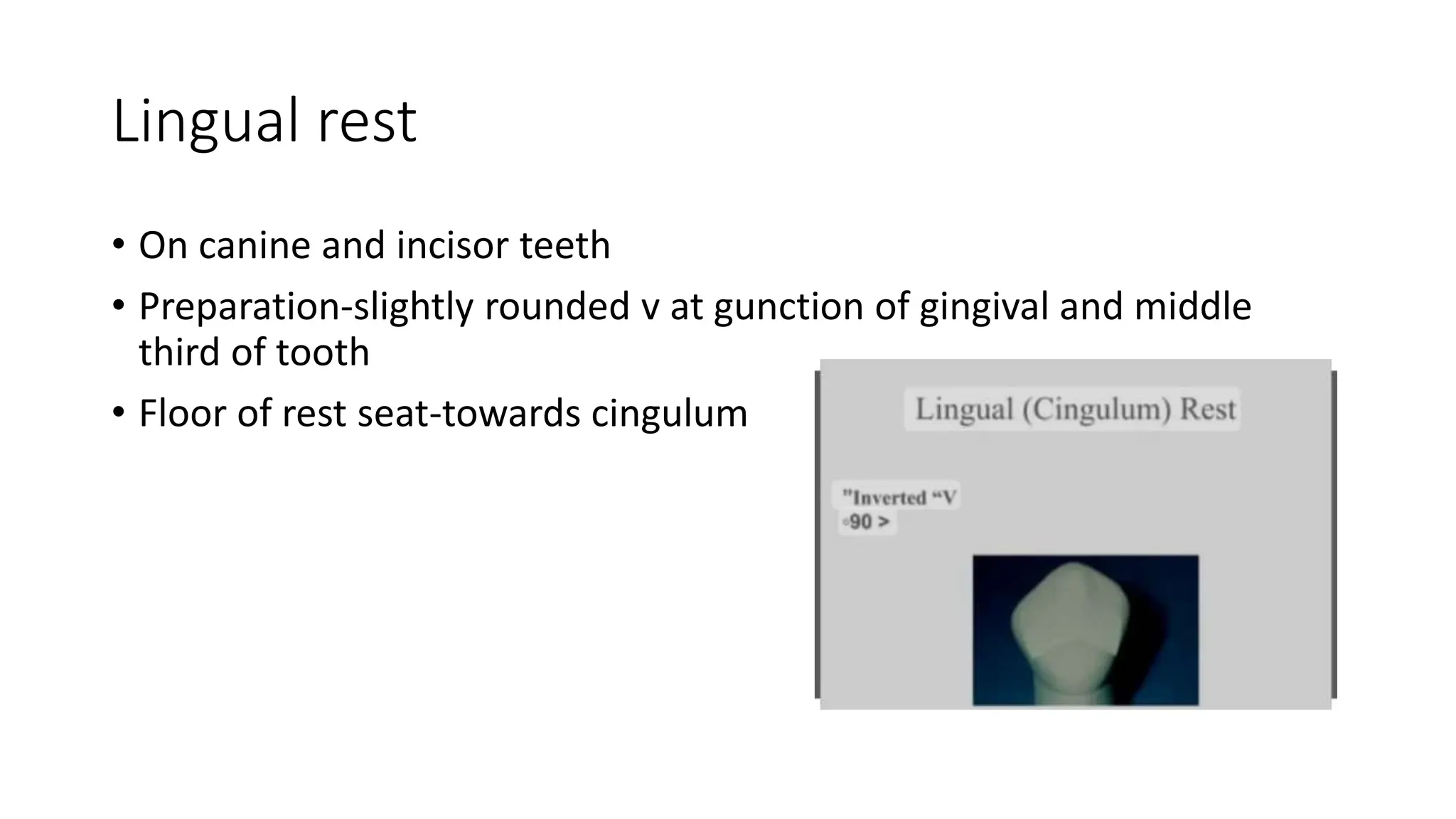 REST AND REST SEATS in prosthodontics ppt | PPTX