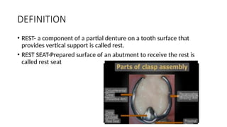 REST AND REST SEATS in prosthodontic dentistry | PPT