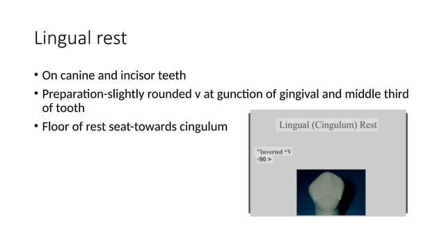 REST AND REST SEATS in prosthodontic dentistry | PPT