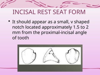 REST AND REST SEATS PPT [Autgvhgvosaved].ppt