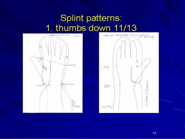 Resting splint research splint provision charlie laver