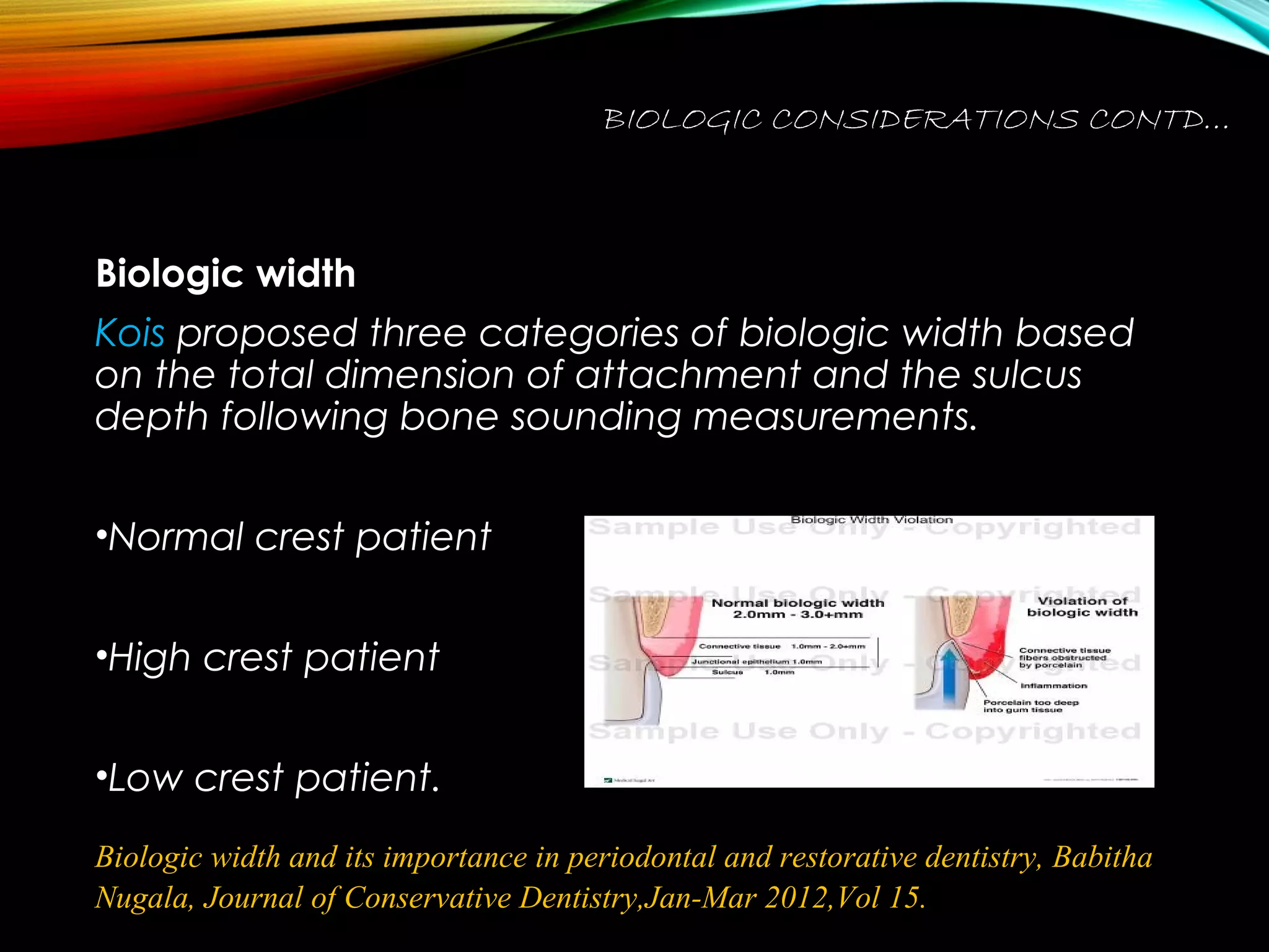 perio restorative | PPT