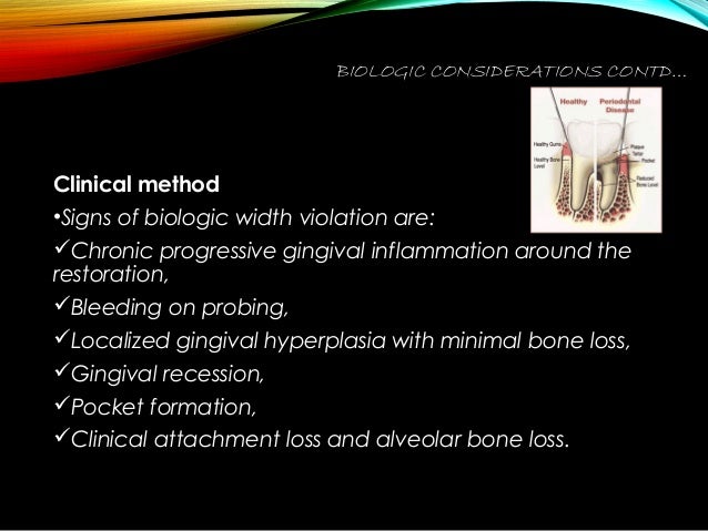 perio restorative