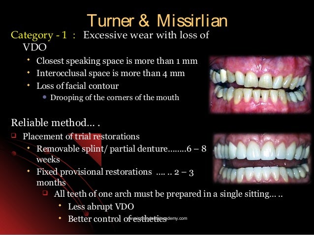 Rest of lost vert dim/ academy general dentistry