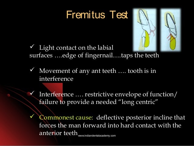 Rest of lost vert dim/ academy general dentistry