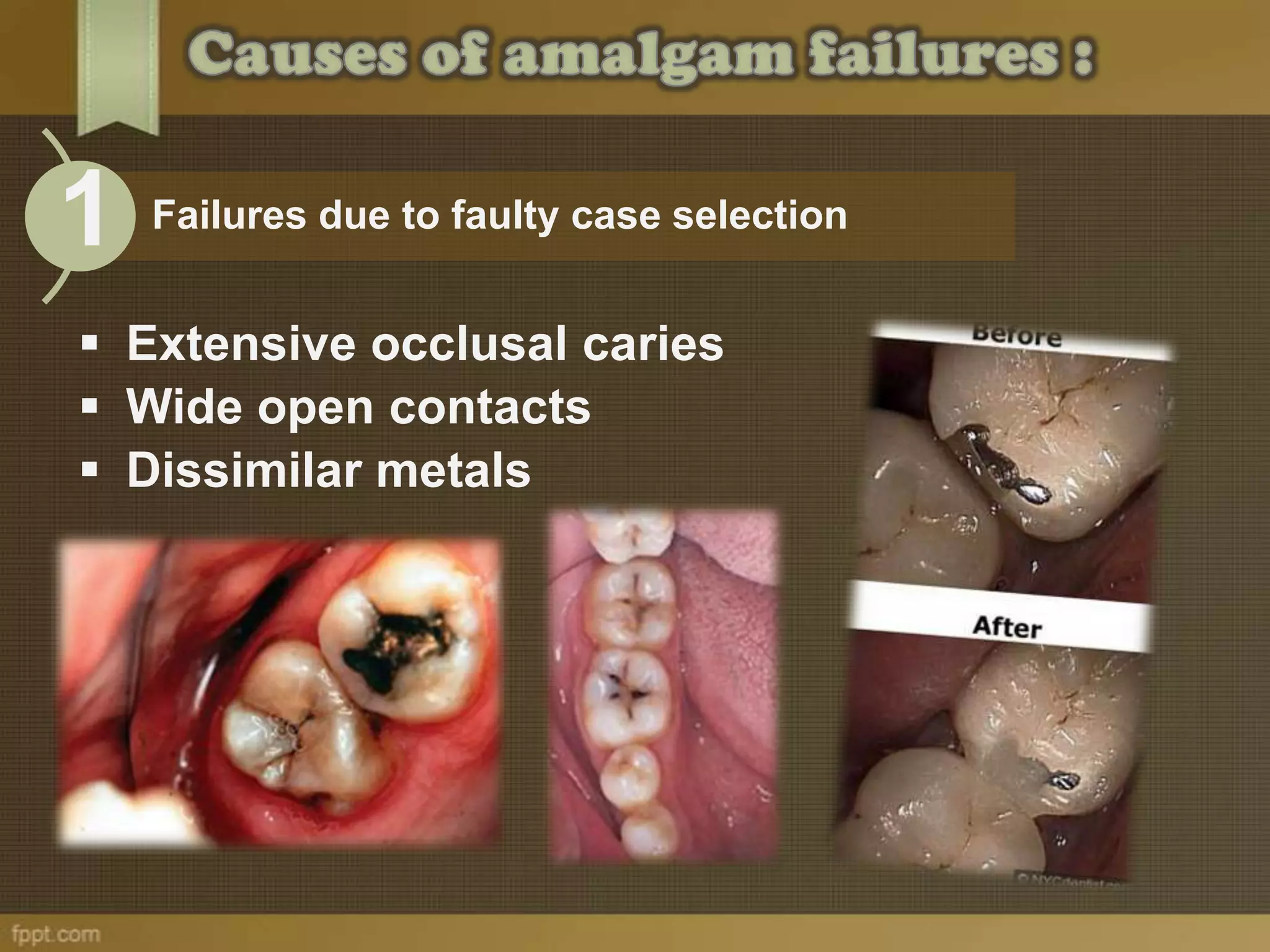 Restoration failure | PPT