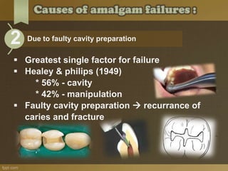Restoration failure | PPTX