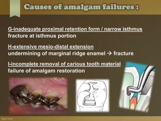 Restoration failure | PPTX