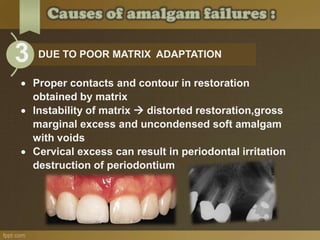 Restoration failure | PPTX