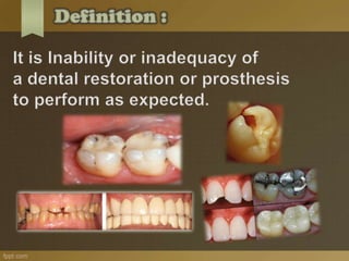 Restoration failure | PPTX