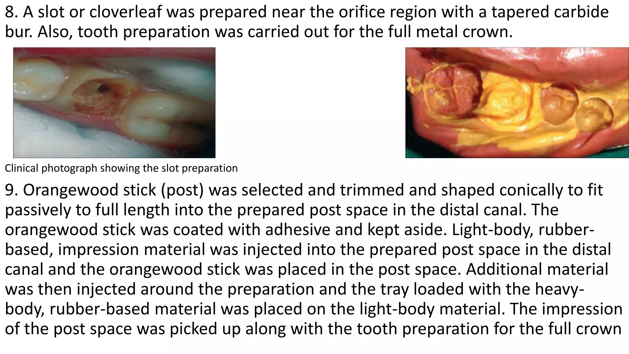 Restoration of badly broken teeth | PPTX