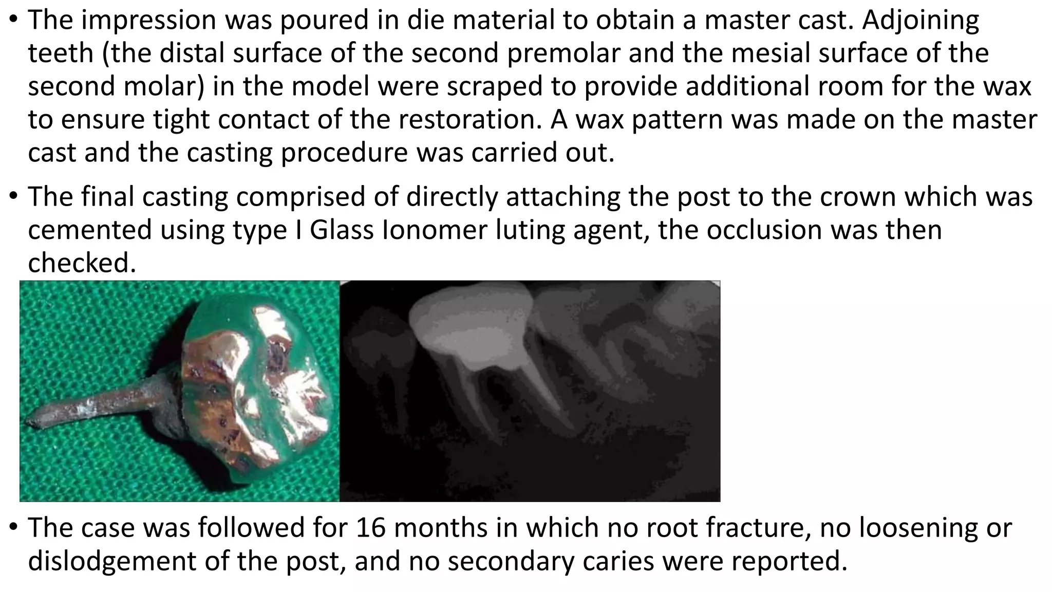 Restoration of badly broken teeth | PPTX