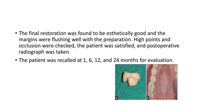 Restoration of badly broken teeth | PPTX | Dental Health | Diseases and ...