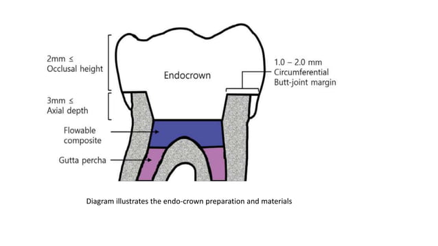 Restoration of badly broken teeth | PPTX | Dental Health | Diseases and ...