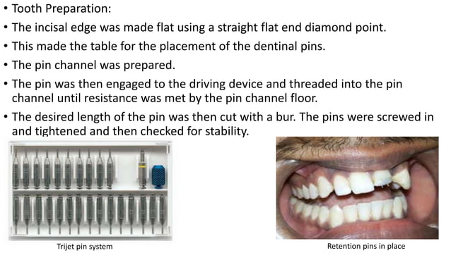 Restoration of badly broken teeth | PPTX | Dental Health | Diseases and ...