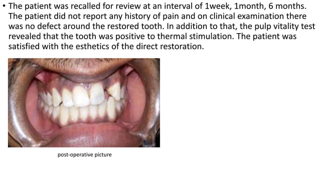 Restoration of badly broken teeth | PPTX | Dental Health | Diseases and ...
