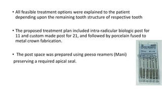 Restoration of badly broken teeth | PPTX