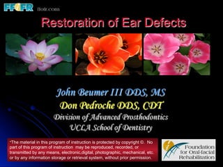 Restoration of ear defects | PDF