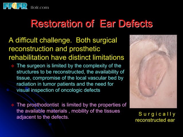 Restoration of ear defects | PDF
