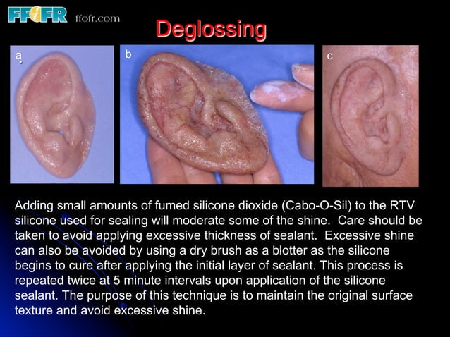 Restoration of ear defects | PDF