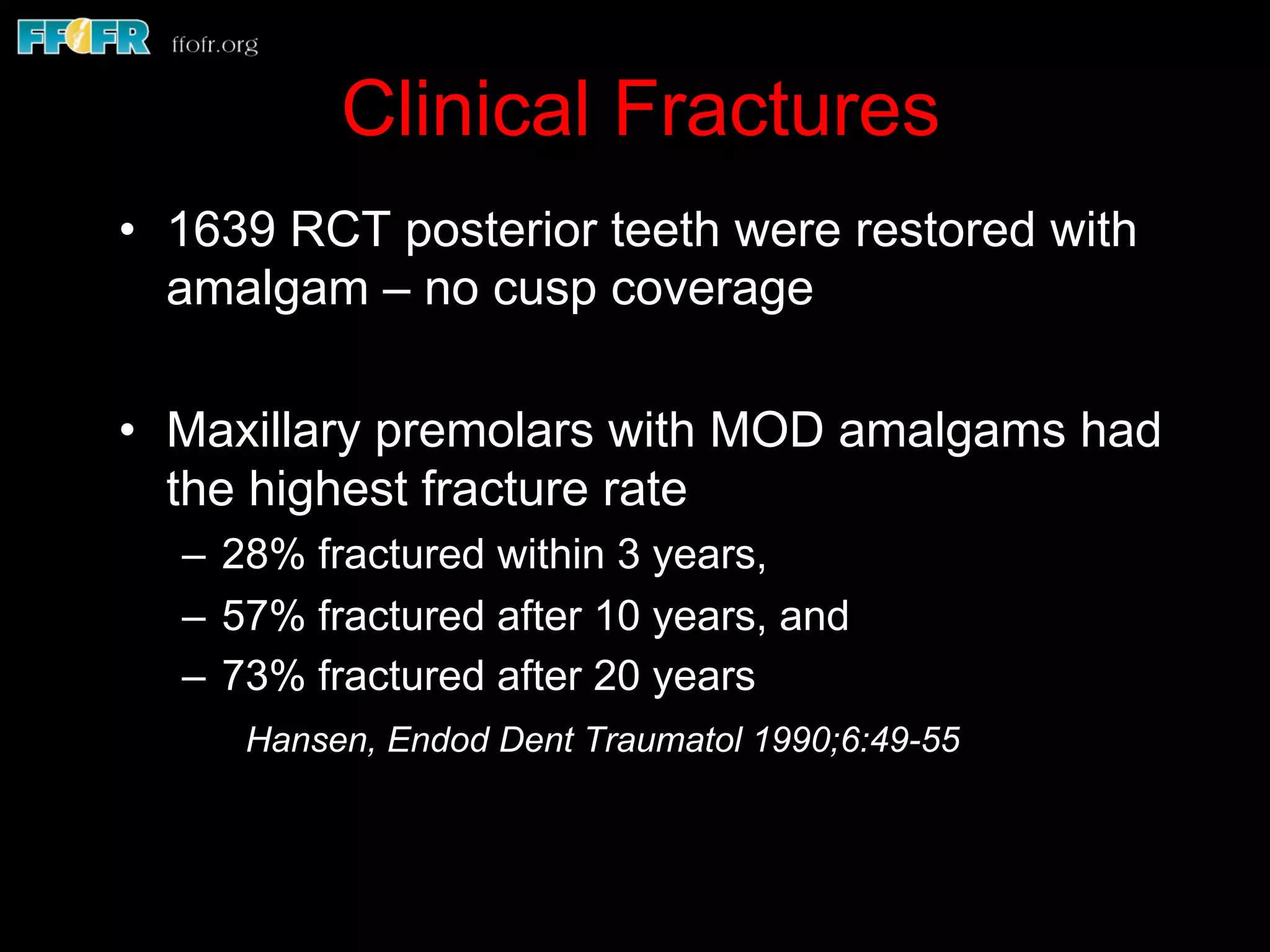Restoration of endodontically treated teeth | PDF