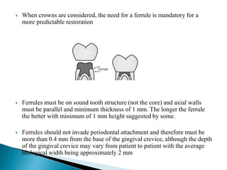 Restoration of endodontically treated teeth | PPTX