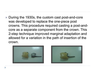Restoration of endodontically treated teeth | PPTX