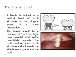Restoration of endodontically treated teeth | PPTX
