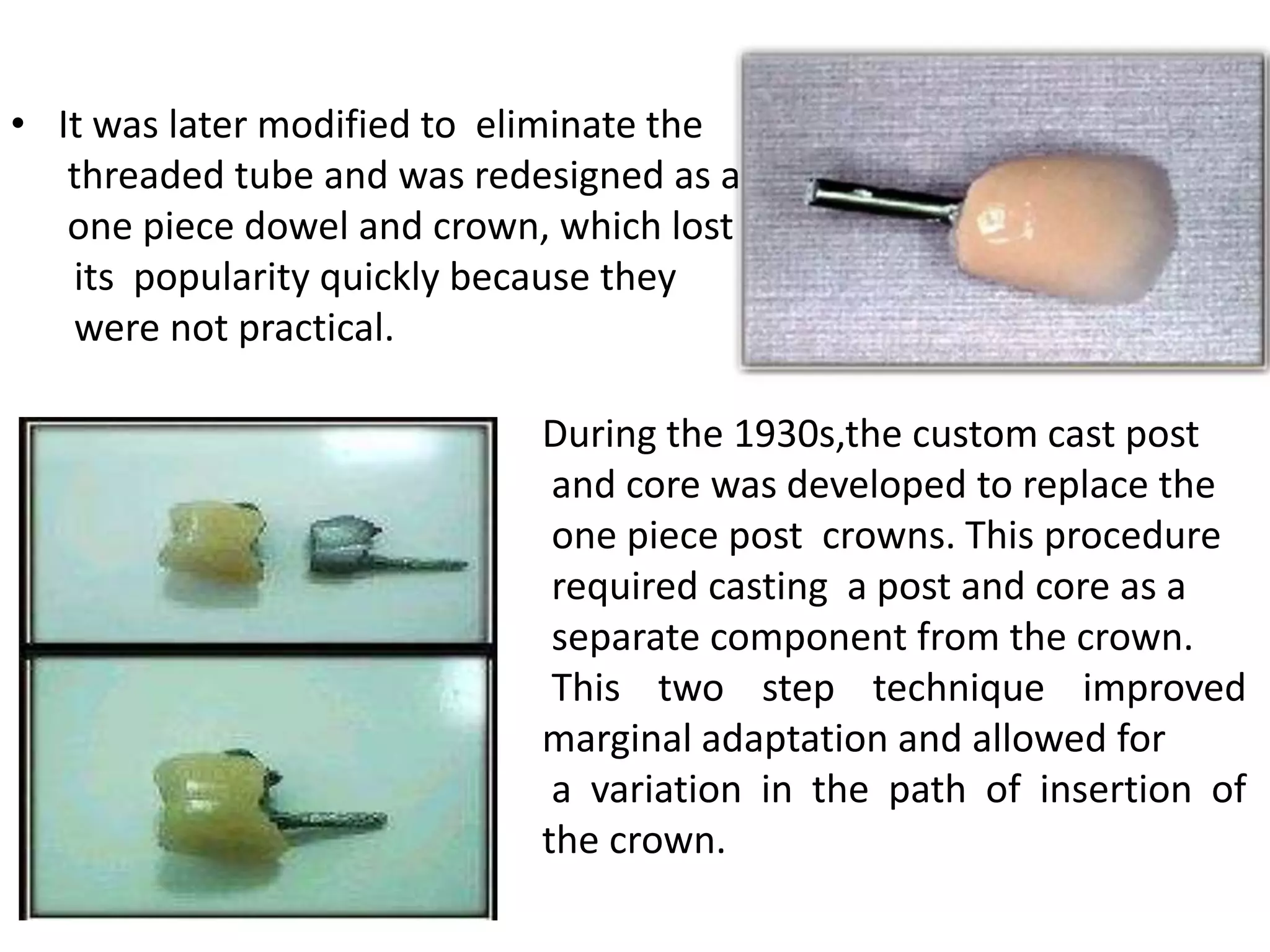 Restoration of endodontically treated teeth | PPTX