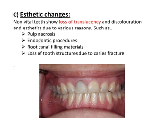 Restoration of endodontically treated teeth | PPTX