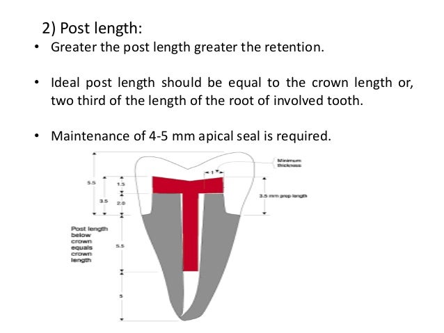 Restoration of endodontically treated teeth