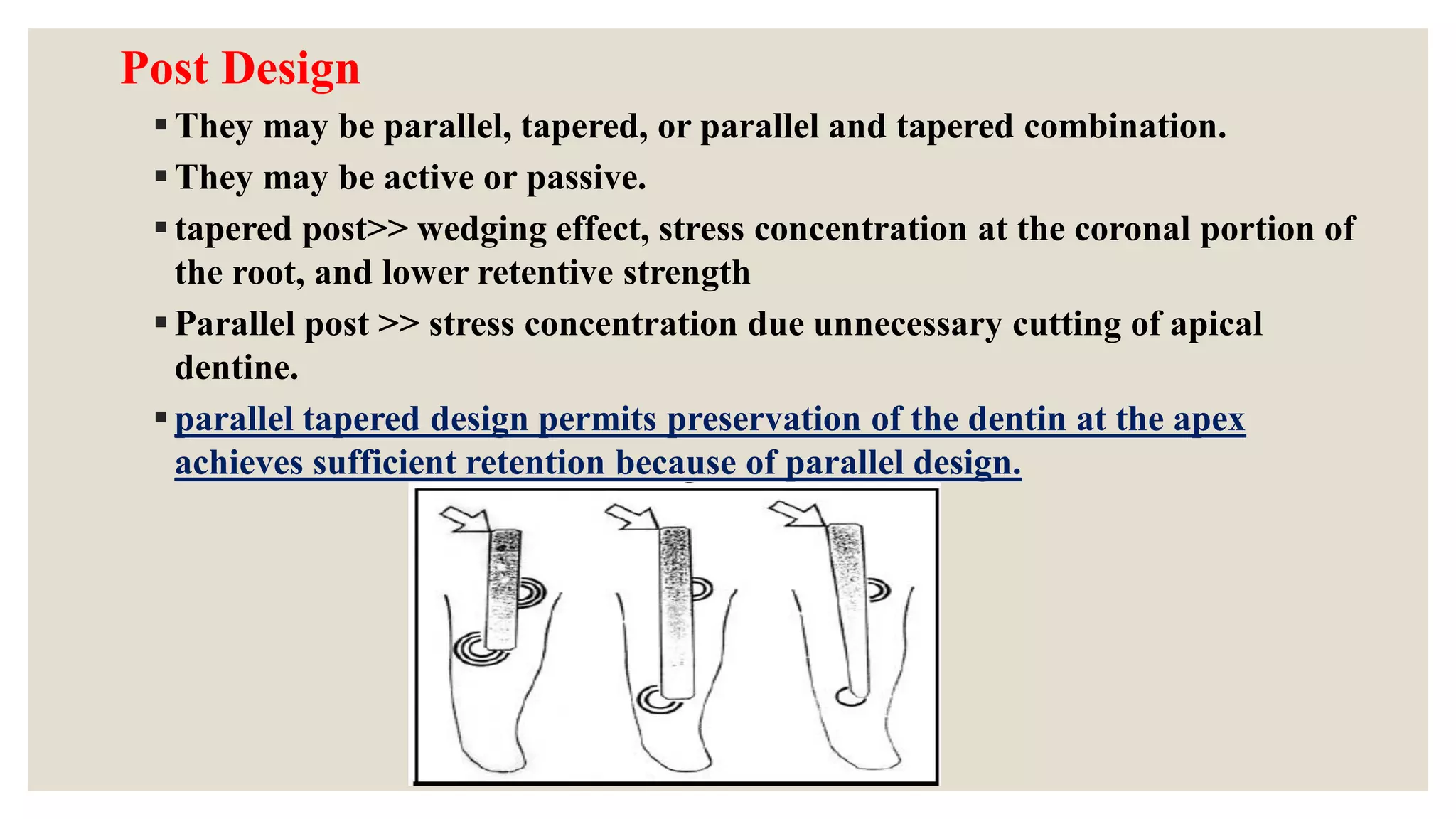 Restoration of endodontically treated teeth | PDF